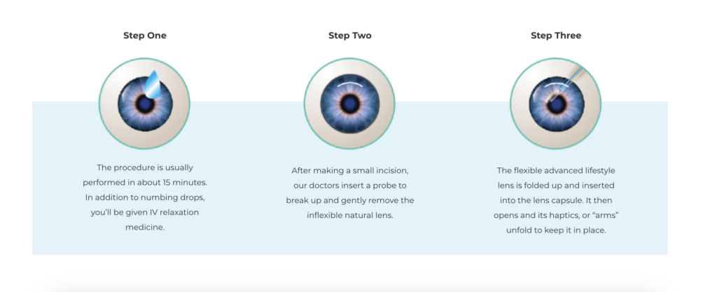About Refractive Lens Exchange (RLE) - The Eye Center