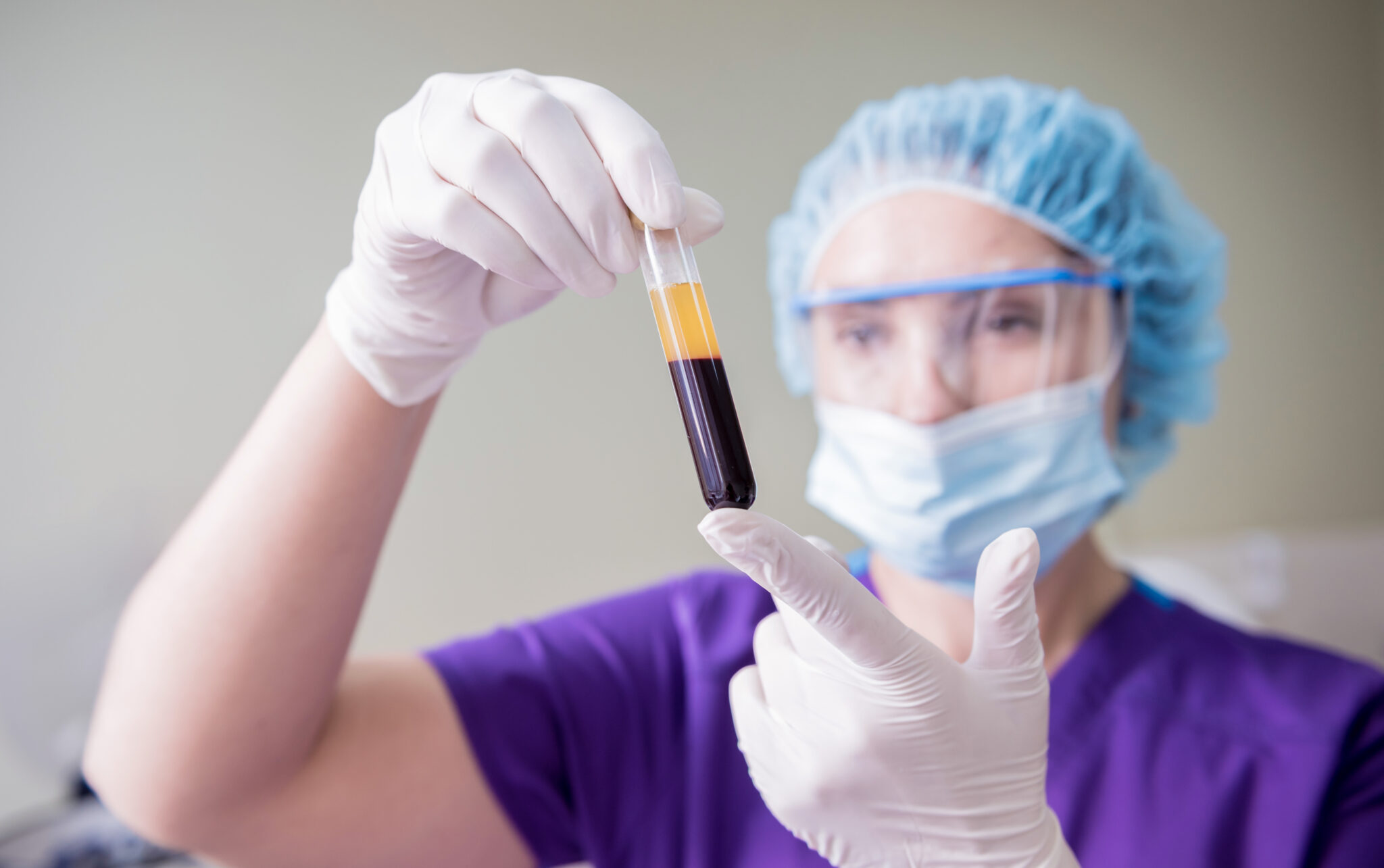 Platelet Rich Plasma (PRP) Tears | The Eye Center